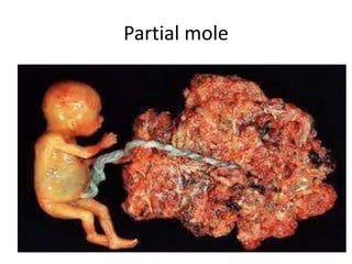 HISTOPATHOLOGICAL SPECIMEN OF OBSTETRICS AND GYNAECOLOGY.pptx