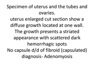 HISTOPATHOLOGICAL SPECIMEN OF OBSTETRICS AND GYNAECOLOGY.pptx