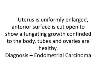 HISTOPATHOLOGICAL SPECIMEN OF OBSTETRICS AND GYNAECOLOGY.pptx
