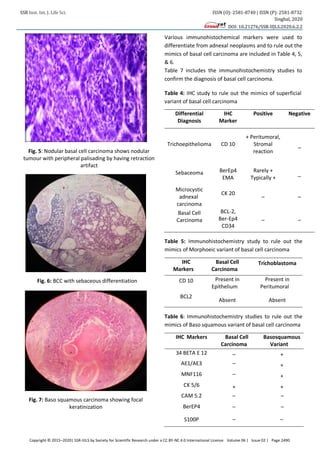 Histopathological_Spectrum_Basal_Cell_Carcinoma_Retrospective.pdf