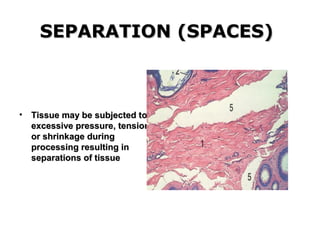 Histopathological technique | PPT