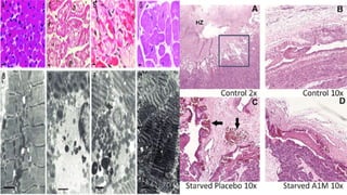 HistoPathology pdf.. Arshita Gupta lab technician | PDF
