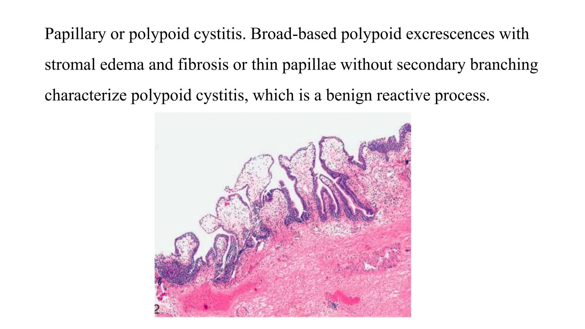 histopathology of bladder and urethra.pptx