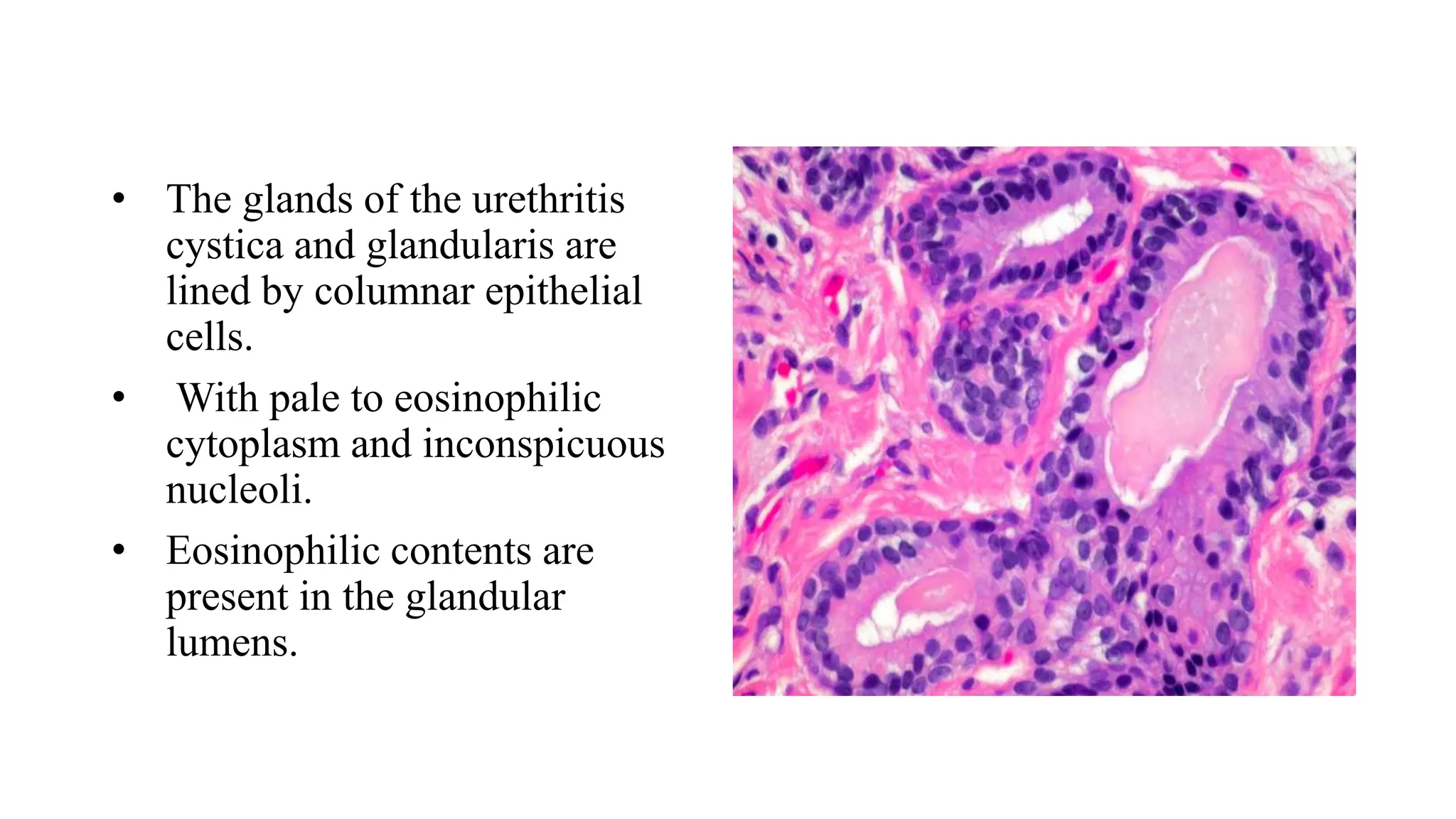 histopathology of bladder and urethra.pptx