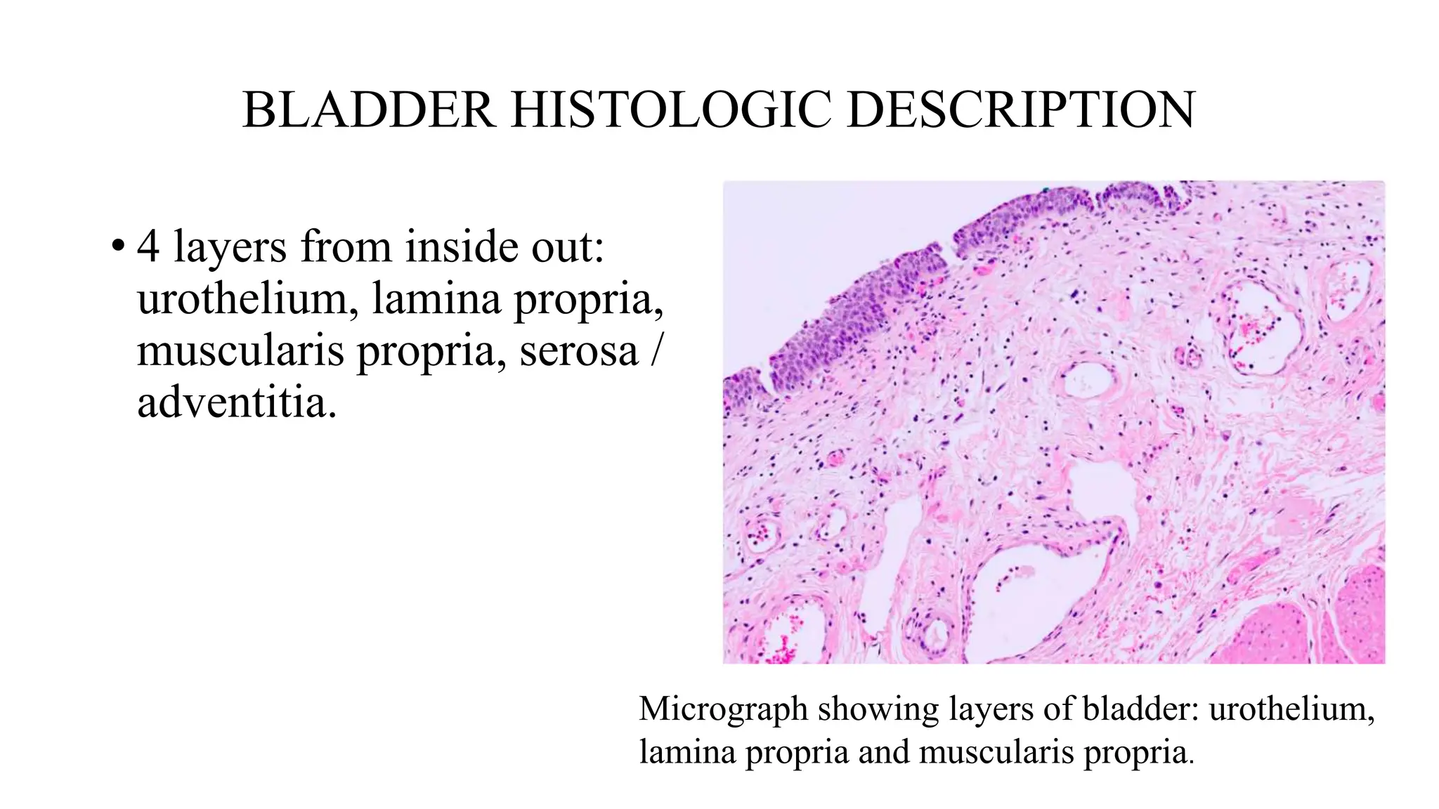 histopathology of bladder and urethra.pptx