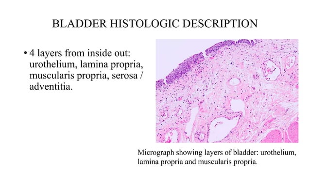 histopathology of bladder and urethra.pptx