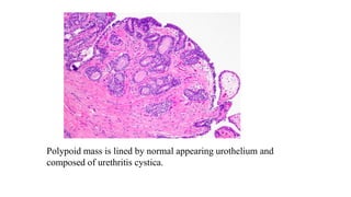 histopathology of bladder and urethra.pdf