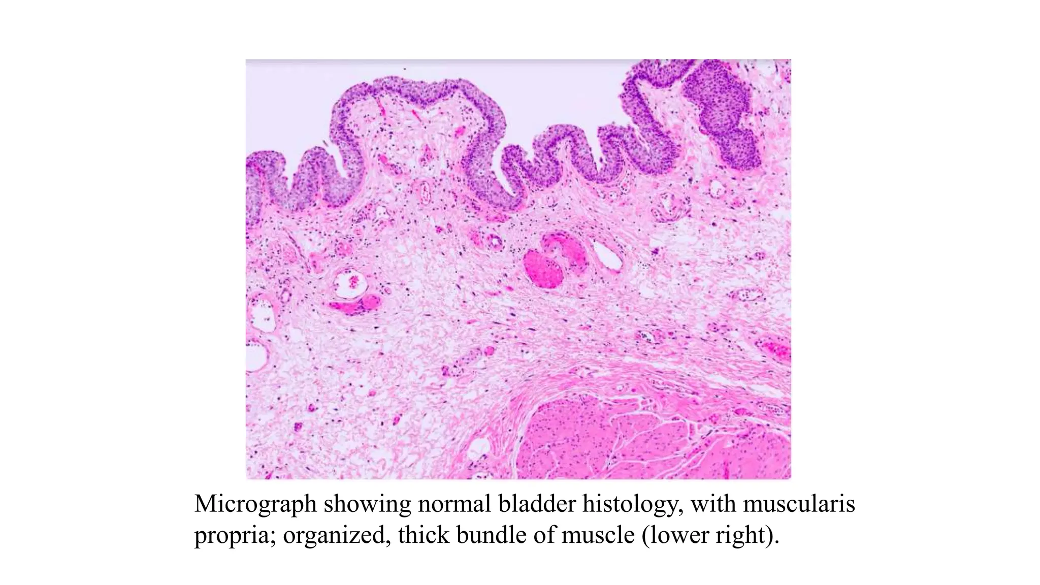 histopathology of bladder and urethra.pptx