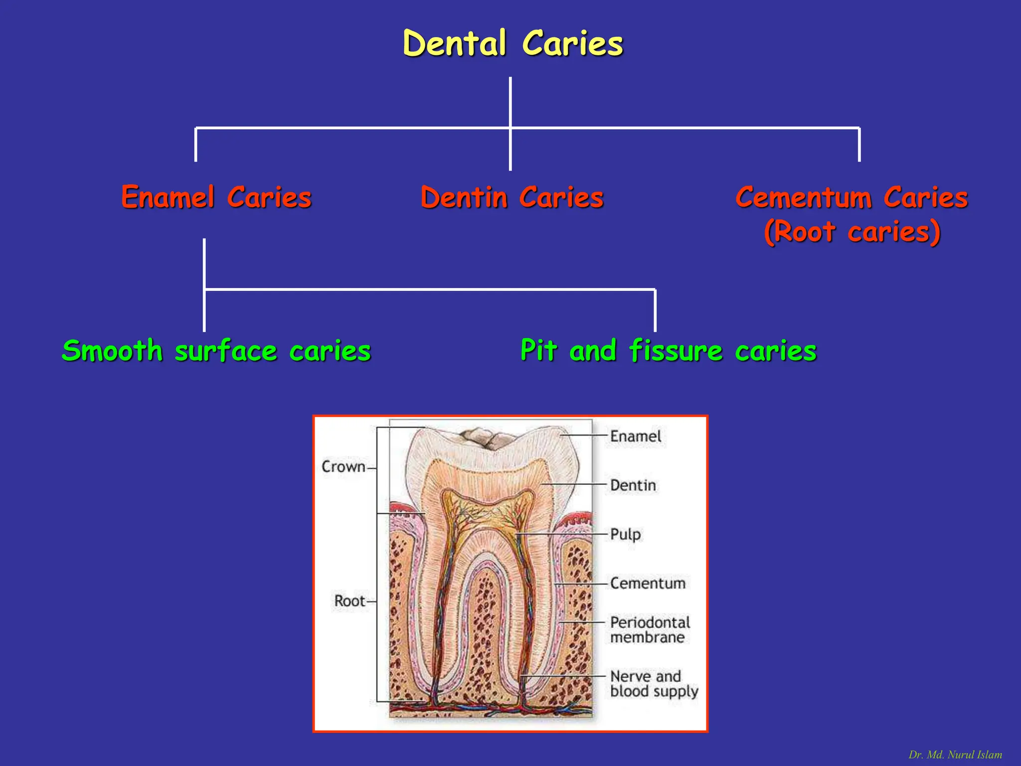 Histopathology_of_dental_Dental_caries_1_compressed.pdf