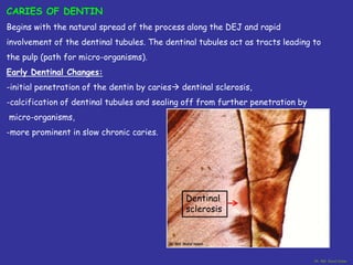 Histopathology_of_dental_Dental_caries_1_compressed.pdf
