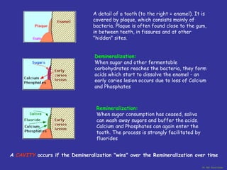 Histopathology_of_dental_Dental_caries_1_compressed.pdf