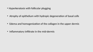 histopathology of lichen et atrophicus dermatology | PPTX