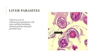 Histopathology of liver.pptxhfhgfhhfhggg | PPTX