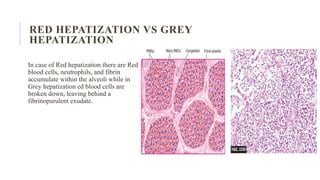 Histopathology of liver.pptxhfhgfhhfhggg | PPT