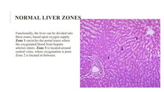 Histopathology of liver.pptxhfhgfhhfhggg | PPTX