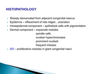 Histopathology of malignant melanoma | PPTX
