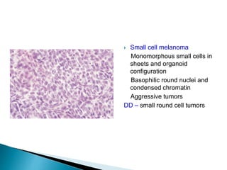 Melanoma Histology