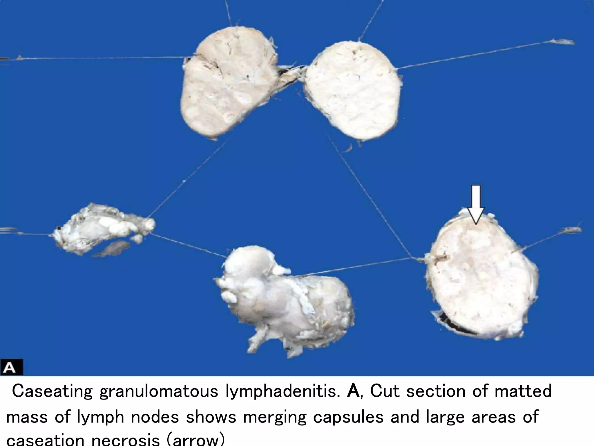 Histopathology slide of | PPTX