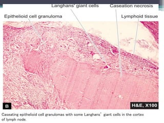 Histopathology slide of | PPTX