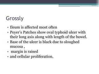 Histopathology slide of | PPT
