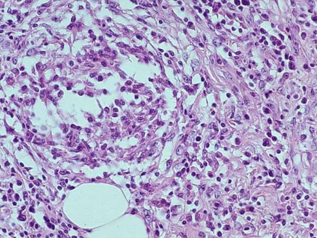 Histopathology slide of | PPT