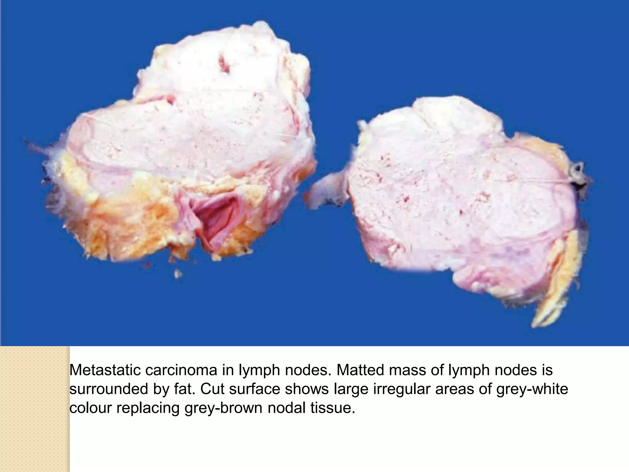 Histopathology slides of | PPTX