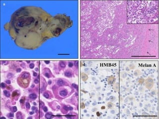 Histopathology slides of | PPTX