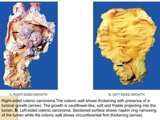 Histopathology slides of | PPT
