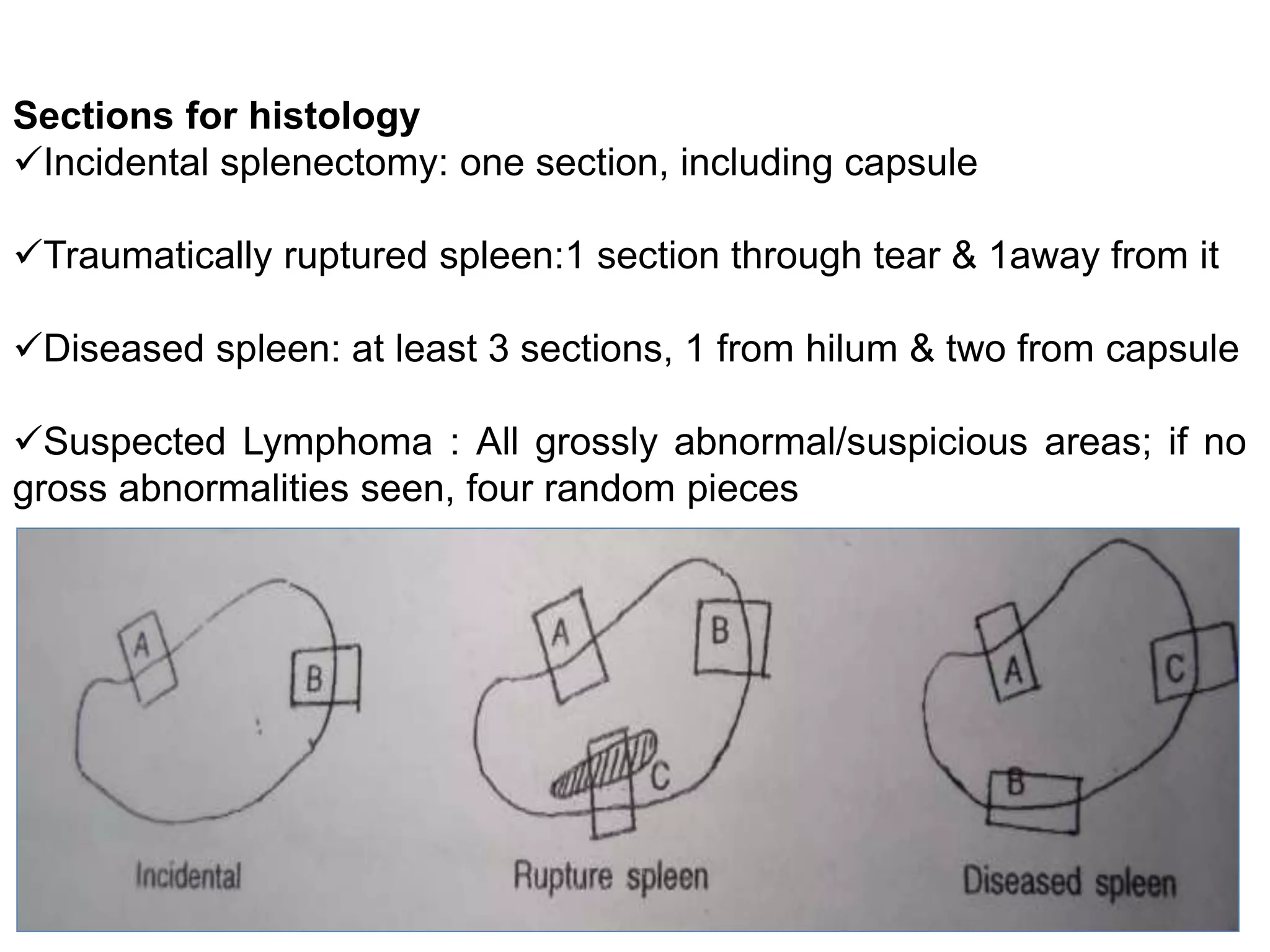 Histopathology specimen processing | PPTX