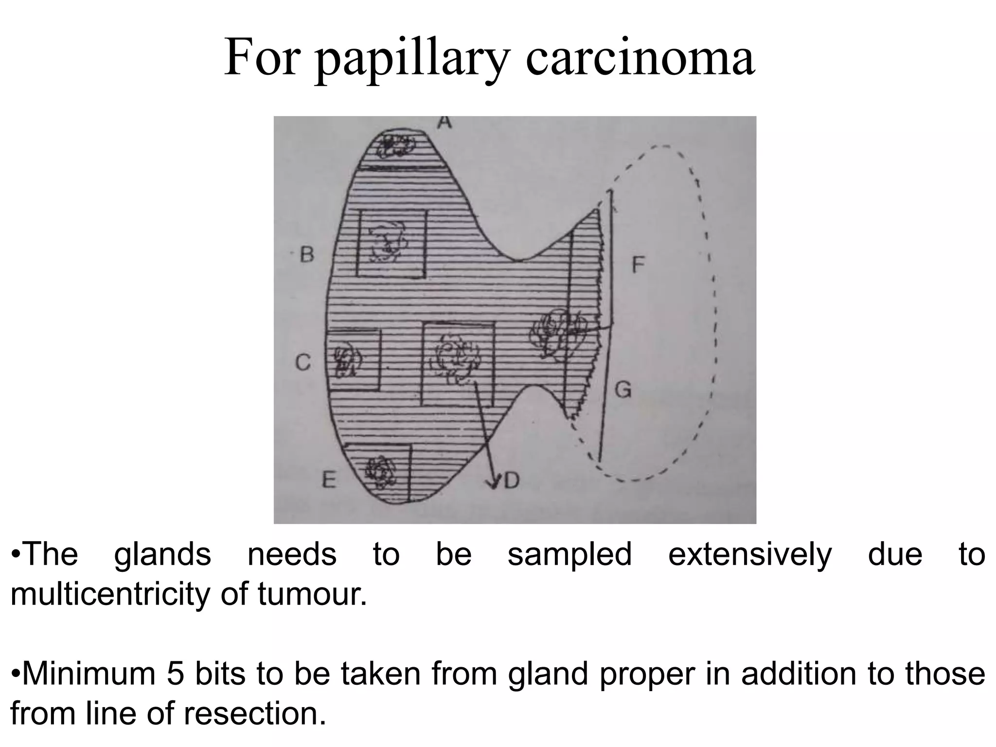 Histopathology specimen processing | PPTX