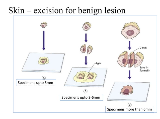 Histopathology specimen processing | PPTX | Chemistry | Science