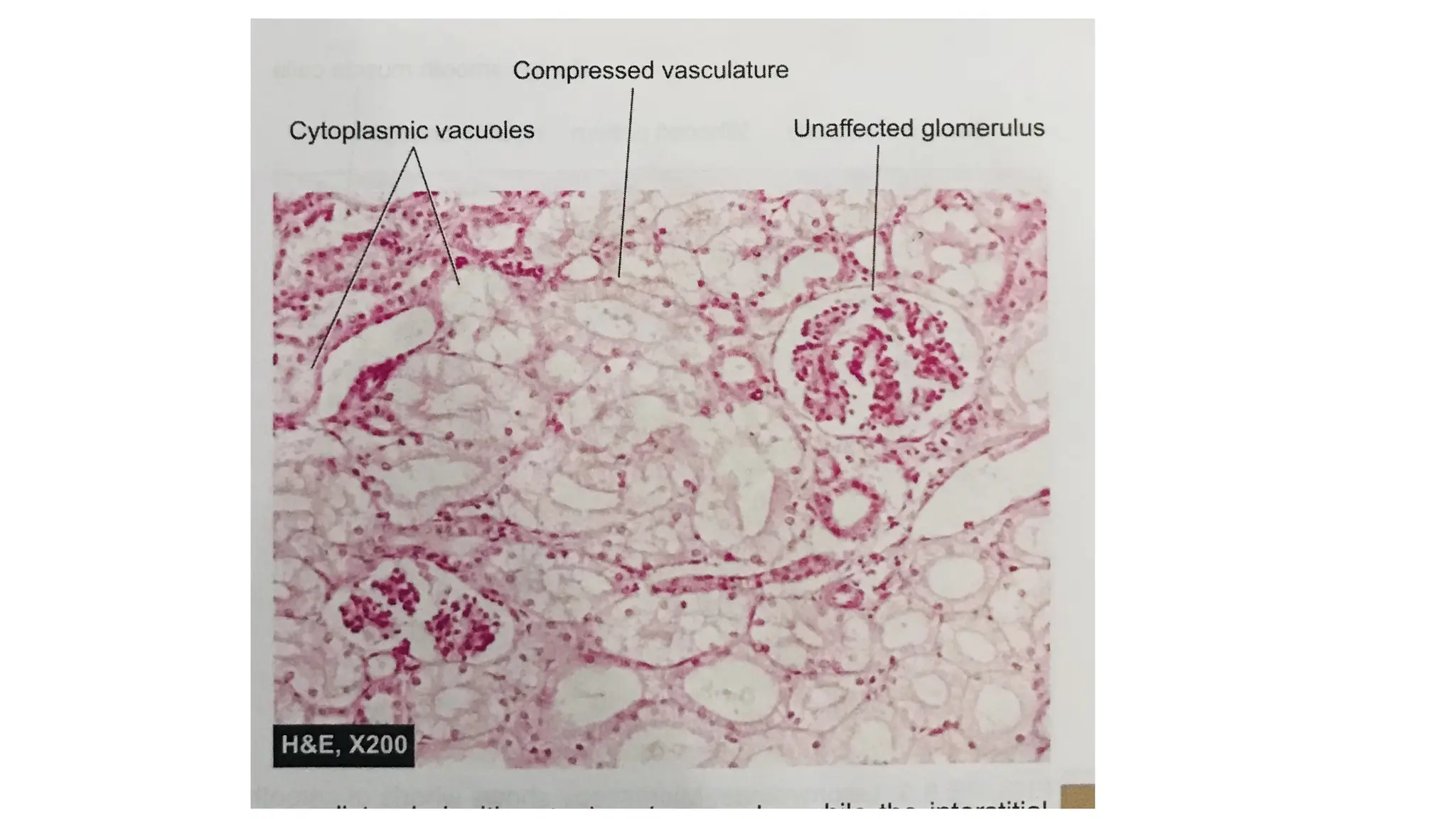 histopath slides.pptx mbbs Second year . | PPT