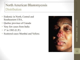 Blastomyces dermatitidis & Histoplasma capsulatum | PPT