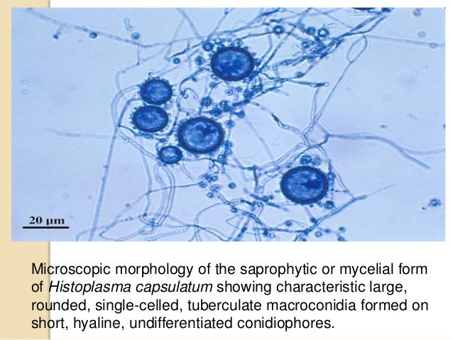 Histoplasmois mycology, epidemiology, laboratory diagnosis