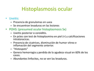 Histoplasmosis | PPTX