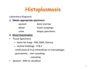 Histoplasmosis | PPTX