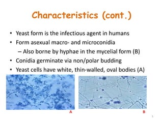 Histoplasmosis | PPTX