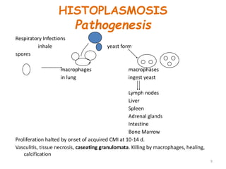 Histoplasmosis | PPTX