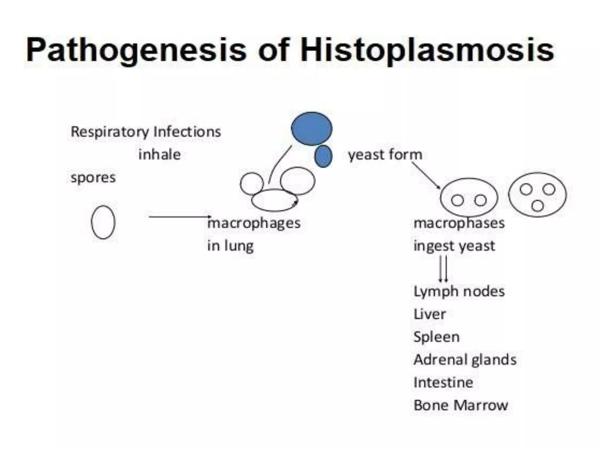 HISTOPLASMOSIS.pptx