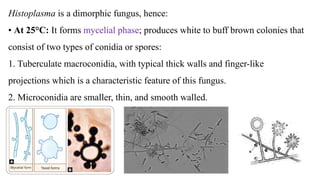 HISTOPLASMOSIS /SYSTEMIC MYCOSES/ Histoplasma capsulatum/ Darling's ...