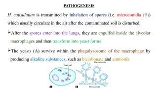 HISTOPLASMOSIS /SYSTEMIC MYCOSES/ Histoplasma capsulatum/ Darling's ...
