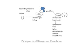 HISTOPLASMOSIS /SYSTEMIC MYCOSES/ Histoplasma capsulatum/ Darling's ...