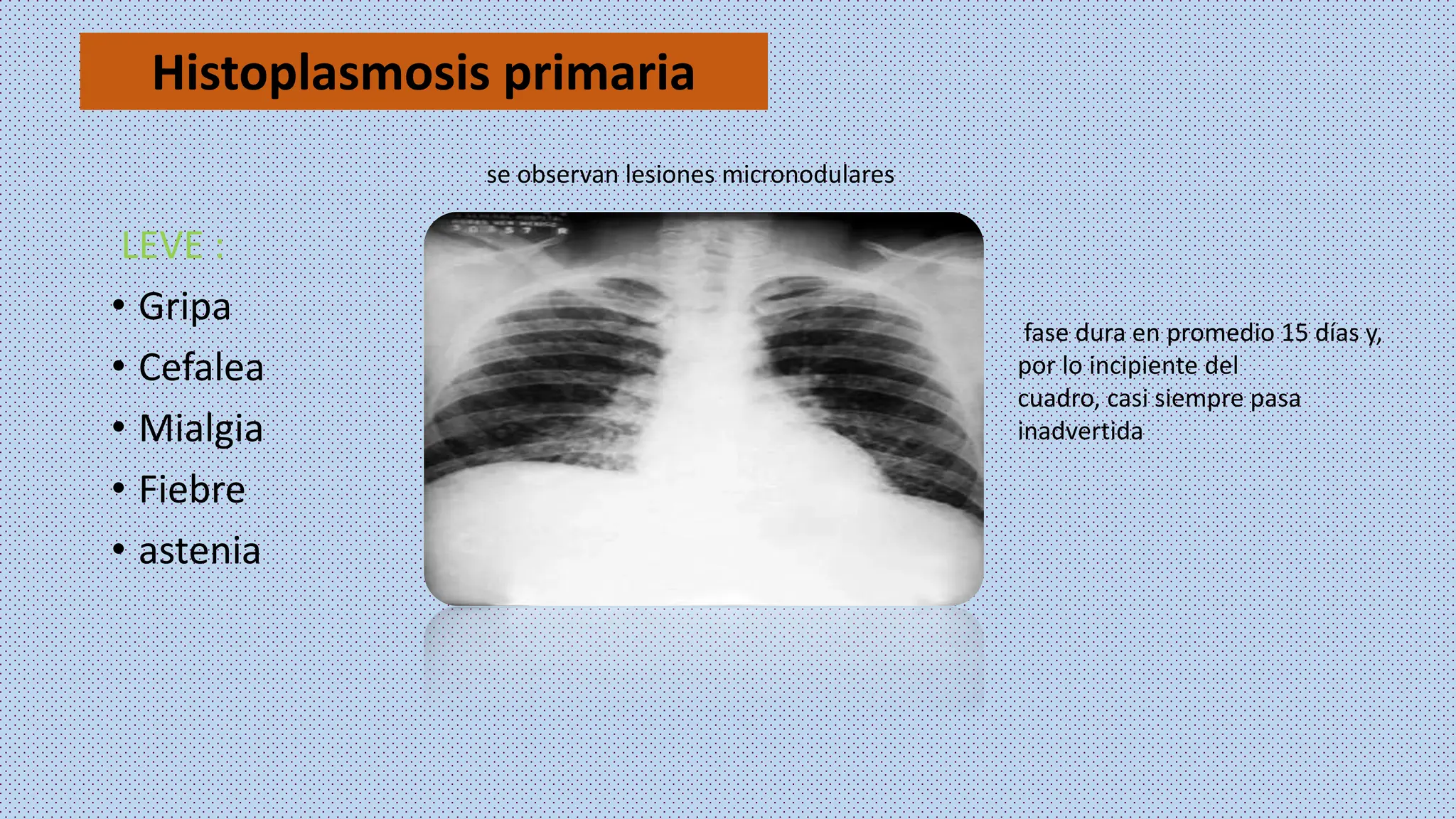 histoplasmosis micologia Médica Medicina.pptx
