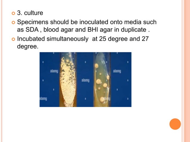 Histoplasmosis | | Systematic mycoses | | | PPT