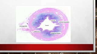 Histopathology Presentation for students and teachers to read and teach ...