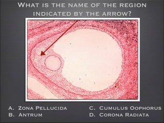 Histo Recognition Update | KEY