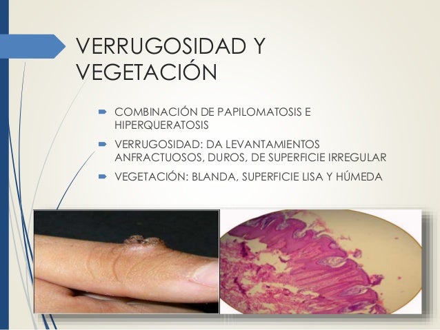 Historia clinica dermatologica 2