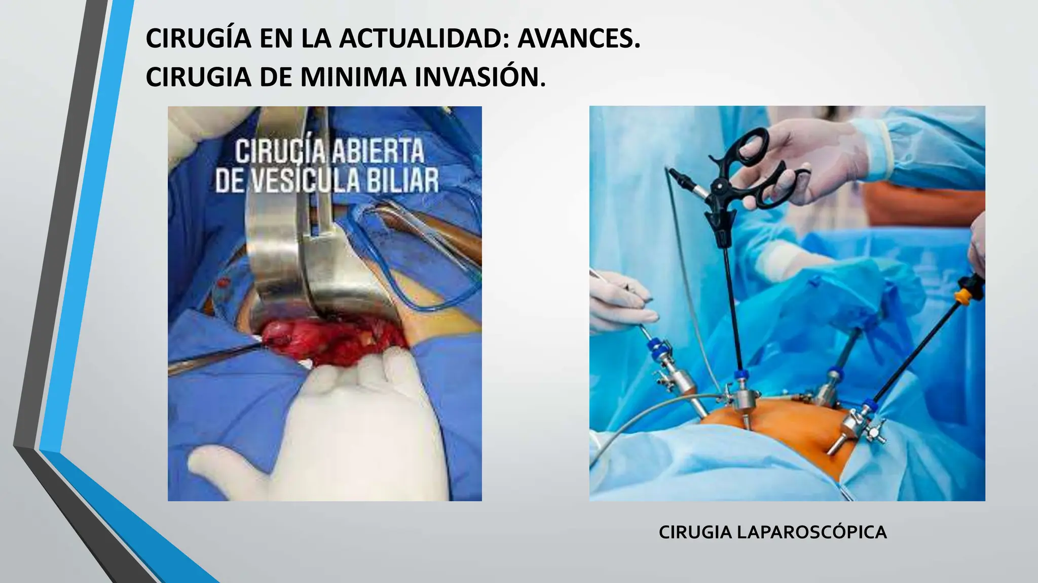 Historia de la Cirugia y procedimientos medicos.ppsx | Surgery ...
