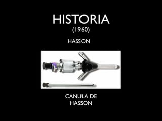 Historia de la laparoscopia | PPT