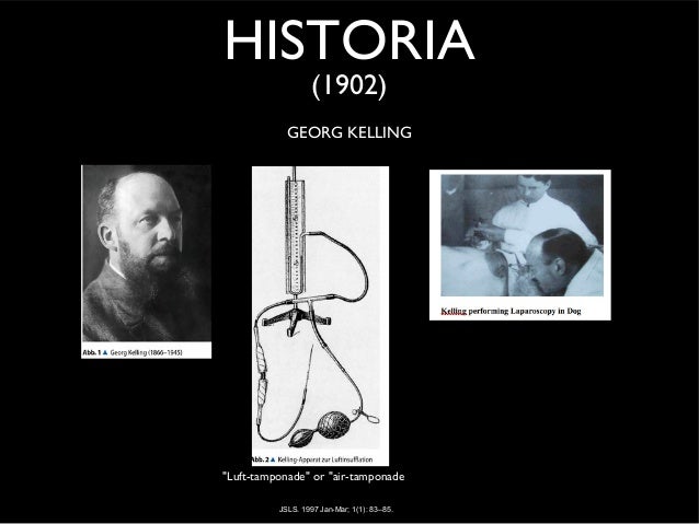 Historia de la laparoscopia